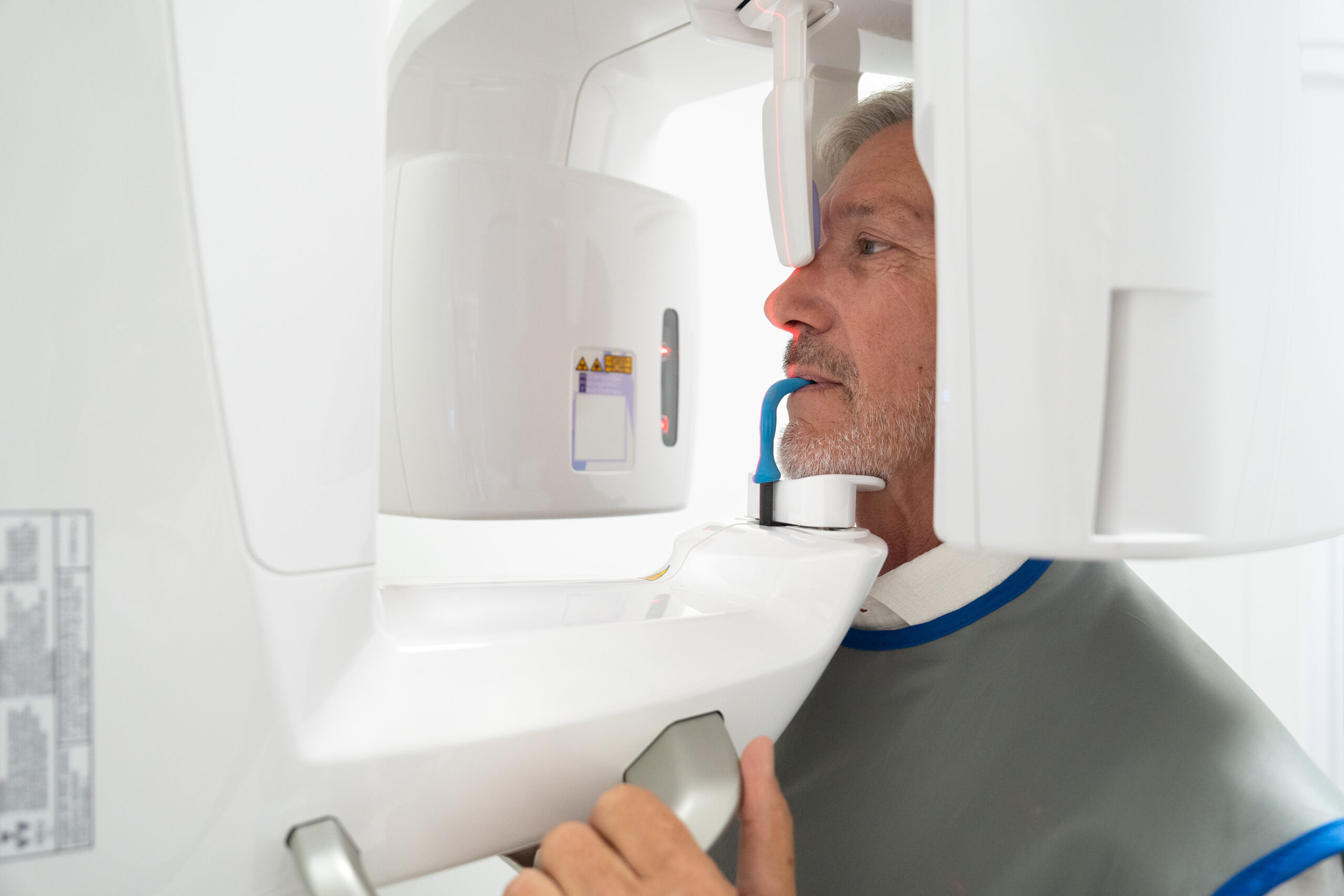 Cos'è la TAC 3D dentale e come funziona? - Confident - Studi Dentistici